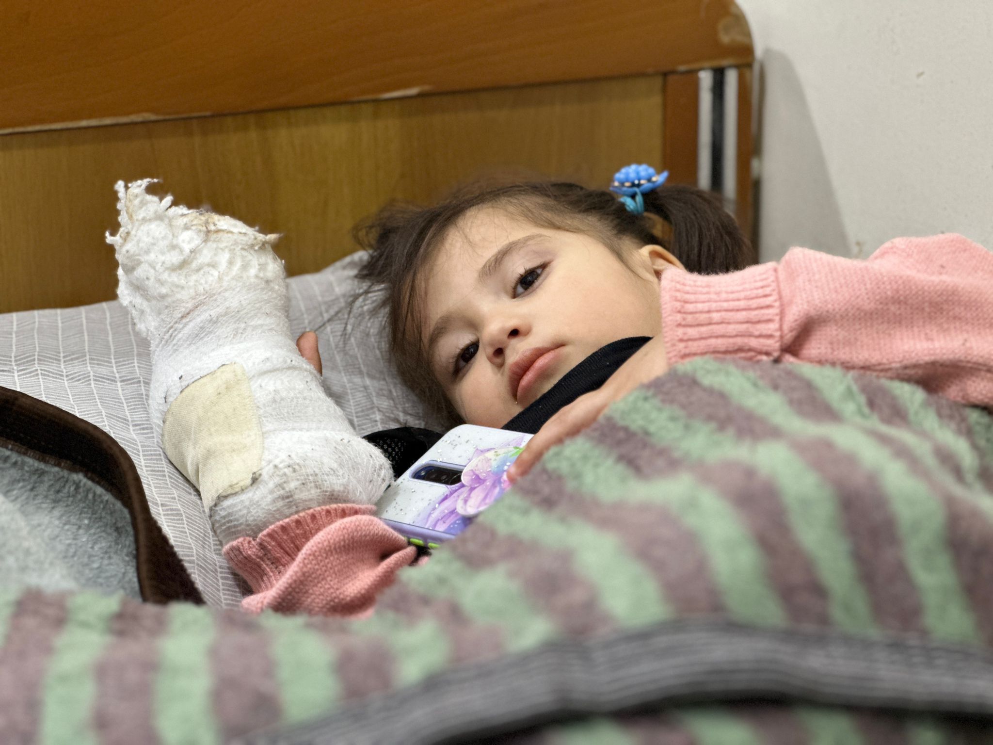 Yasmeen Recovering from Earthquake Injuries - UOSSM USA